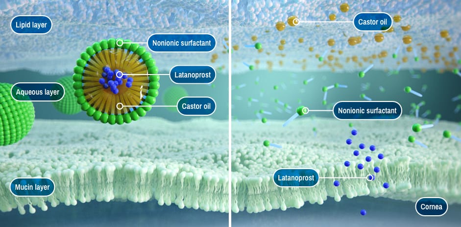 Treatment for Glaucoma | About XELPROS®